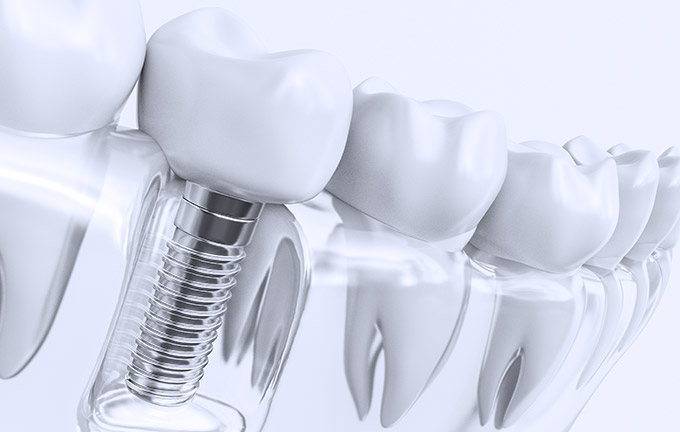 Ball Bearings for Medical Technology: High-Precision Solutions │ GRW - GRW